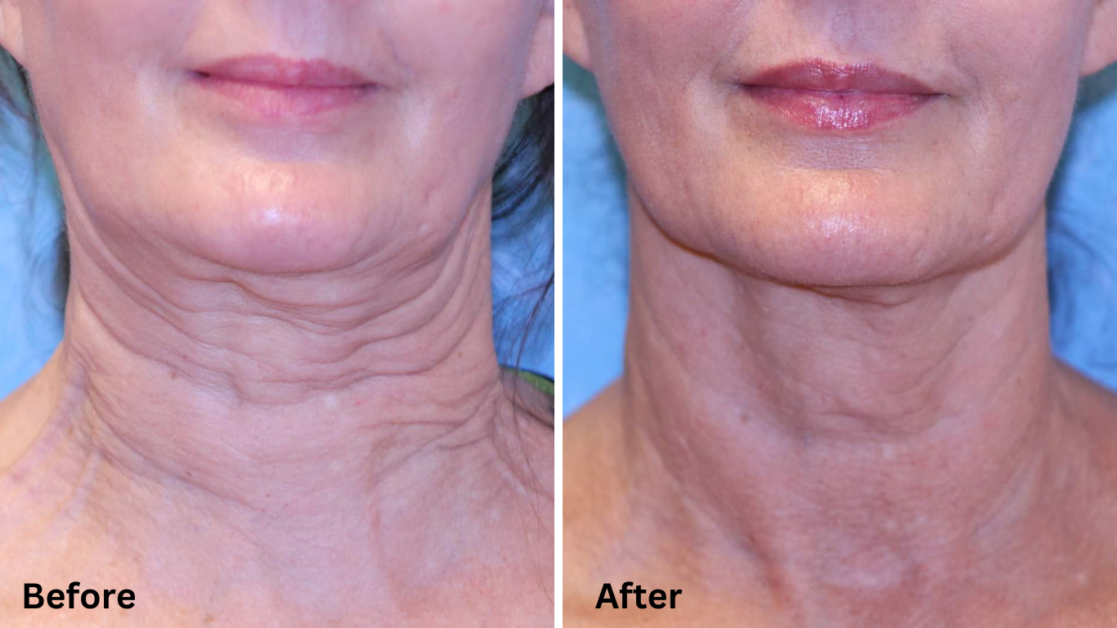 What's Happening - MidState Skin Institute