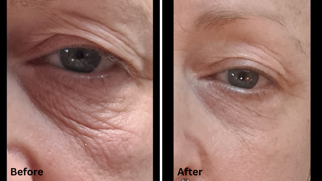 What's Happening - MidState Skin Institute