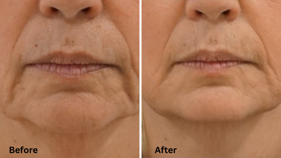 What's Happening - MidState Skin Institute