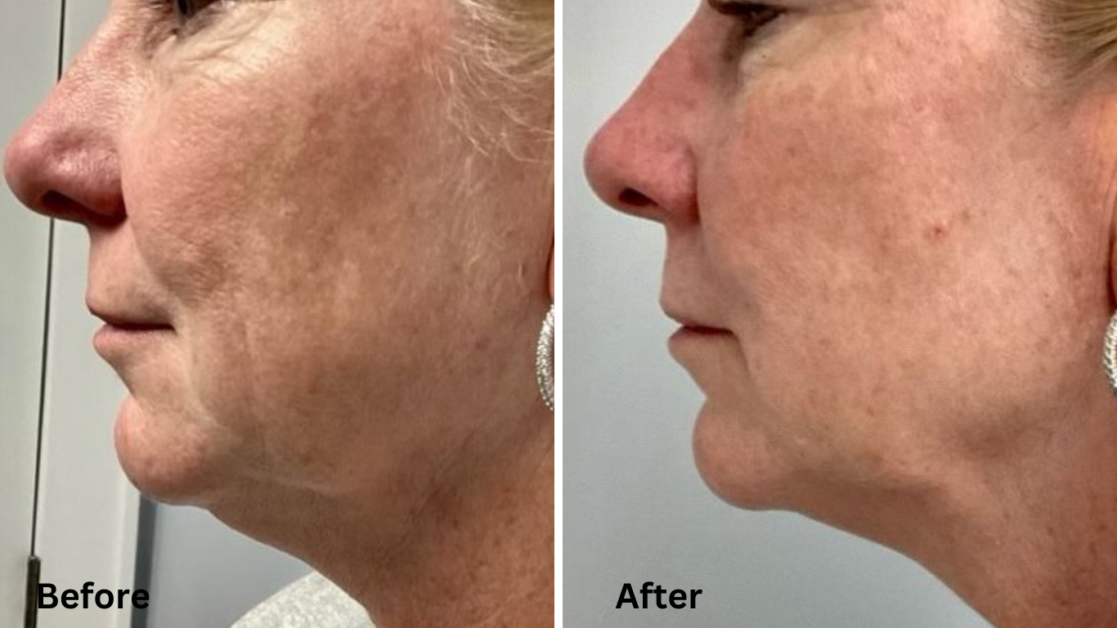 What's Happening - MidState Skin Institute