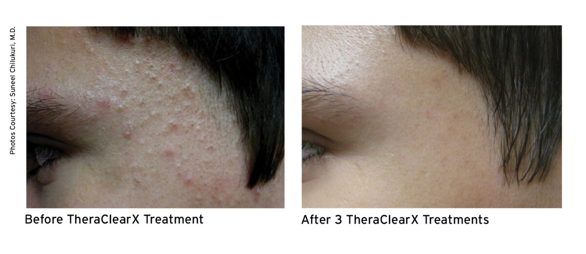 What's Happening - MidState Skin Institute