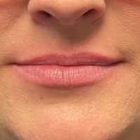 Gallery - MidState Skin Institute