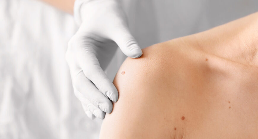 How dust destroy skin tissues - MidState Skin Institute